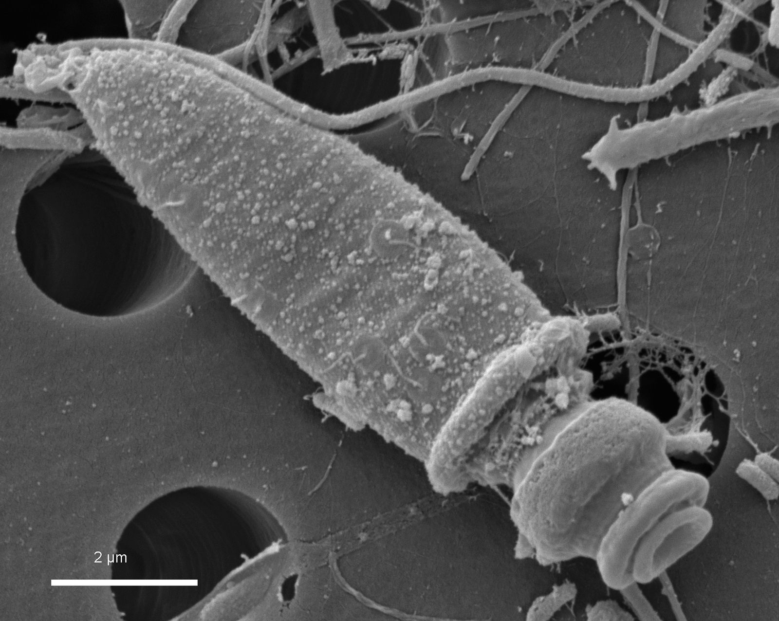 In Photos: Tiny Plankton Show Off Advanced Weaponry | Live Science