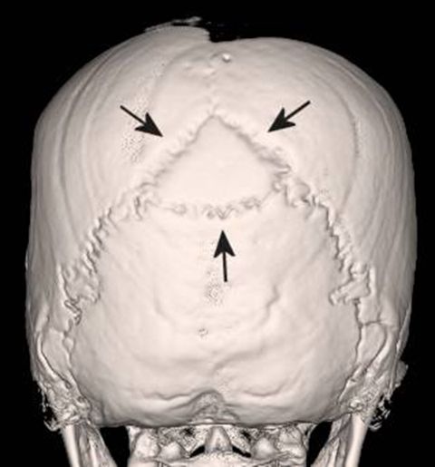 In Images: The Mummy of A Murdered Incan Woman | Live Science