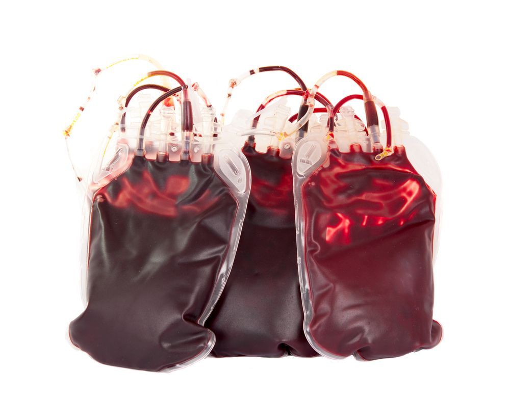 Bloodletting May Provide Health Benefits for Obese | Live Science