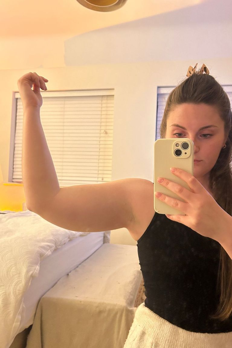 Airsculpt On Arms: Review and Process With Photos | Marie Claire UK