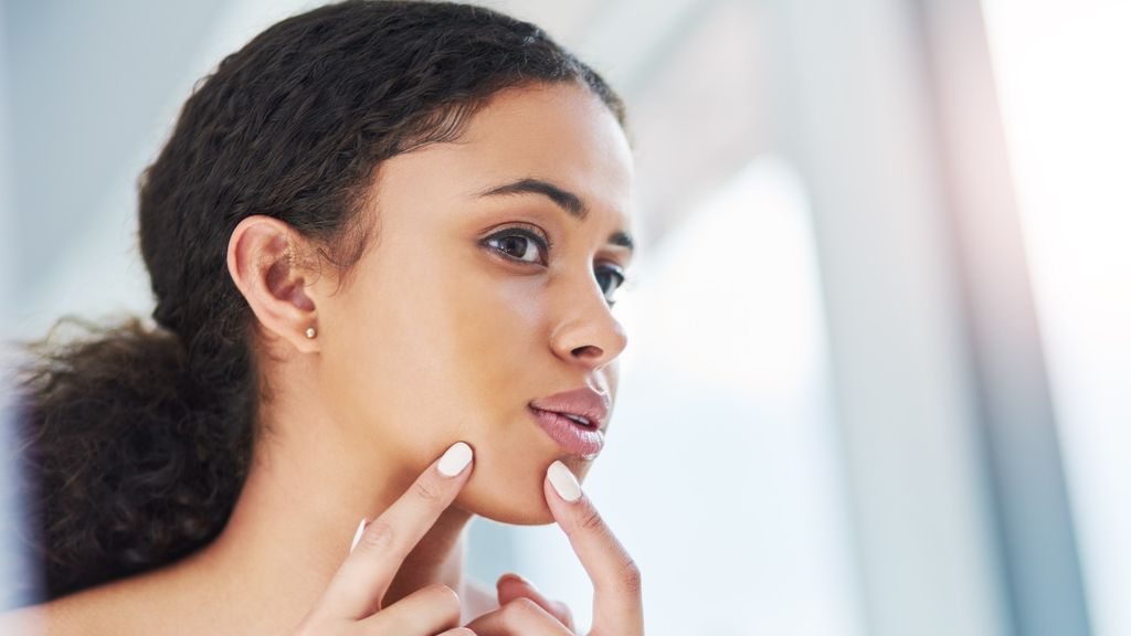 How to Pop a Pimple in the Safest Way Possible, According to ...