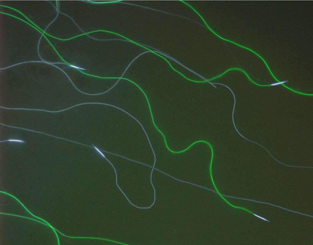 How a Jellyfish Protein Transformed Science | Live Science