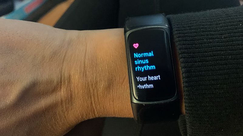 Does the Fitbit Charge 5 have ECG? | Android Central