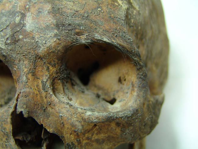 Greek Mummy Found in Lead Coffin | Live Science