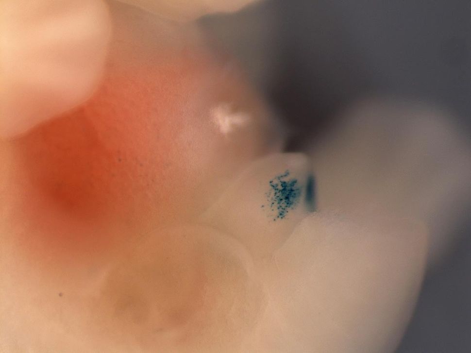 In Photos: How Snake Embryos Grow a Phallus | Live Science