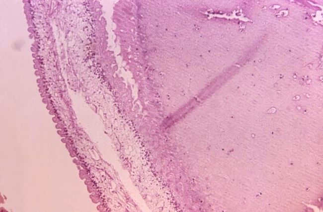 Brain-Infecting Parasite May Lurk Quietly for Years | Live Science