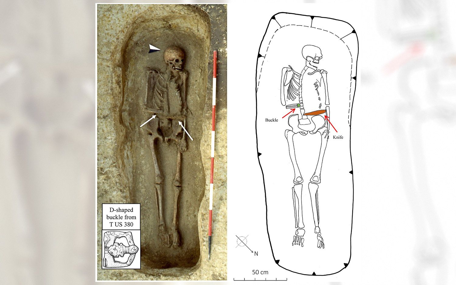 Knife-Armed Man Leaves World's Coolest Skeleton | Live Science