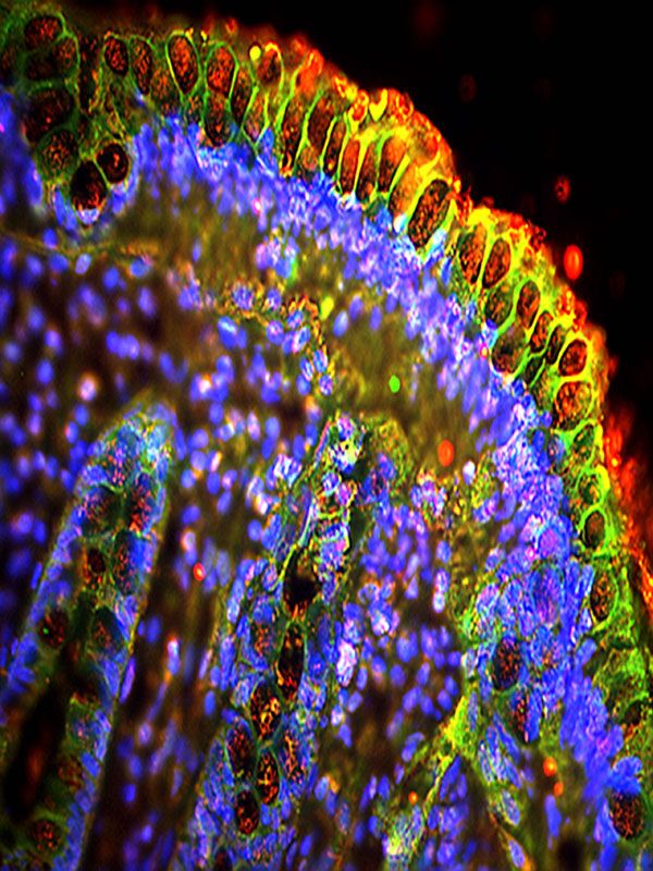 Gallery: The Art in Biomedical Research | Live Science