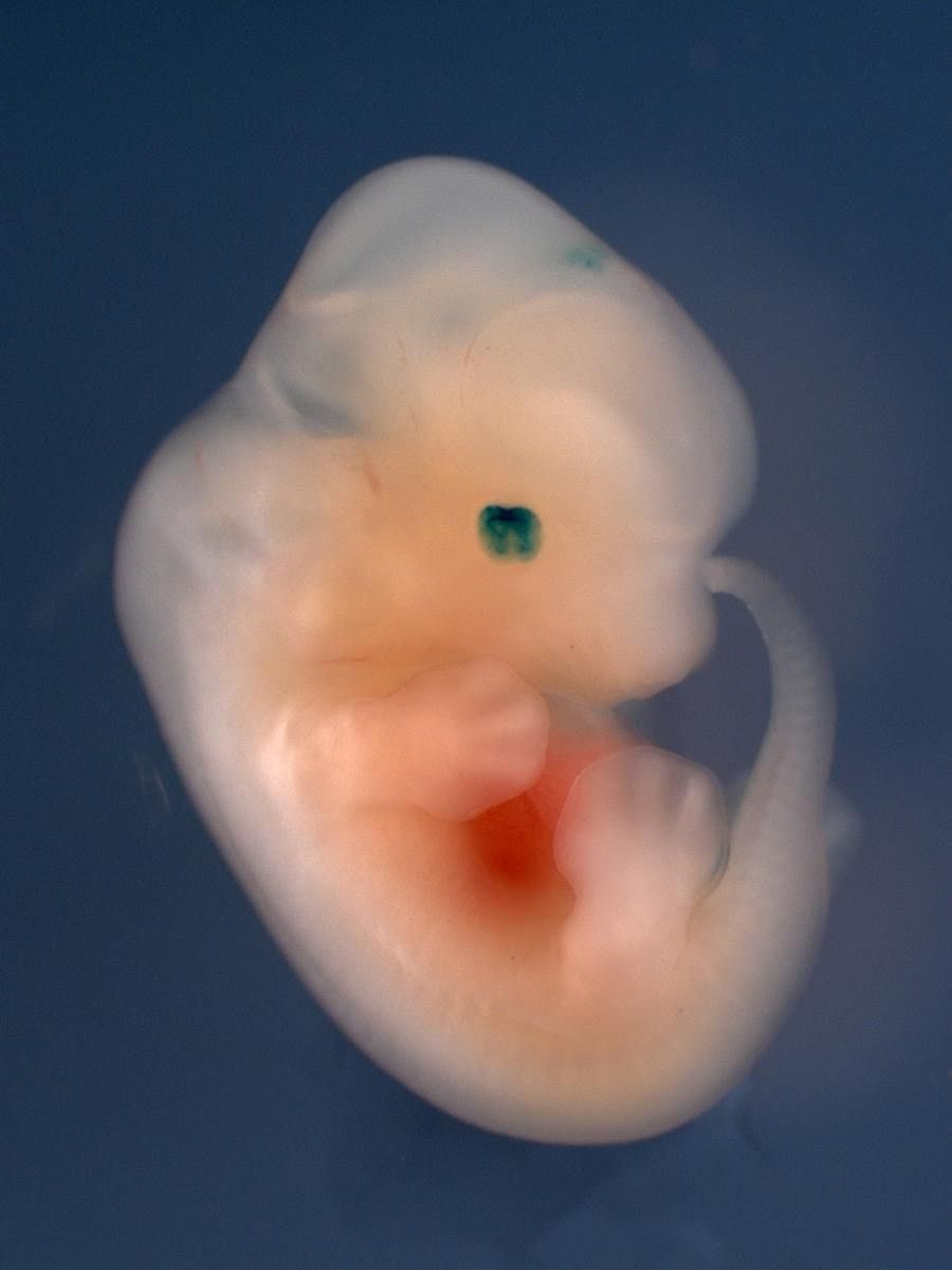In Photos: How Snake Embryos Grow a Phallus | Live Science