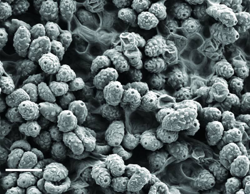 Meet SpongeBob Mushroom, a Funky New Fungus | Live Science
