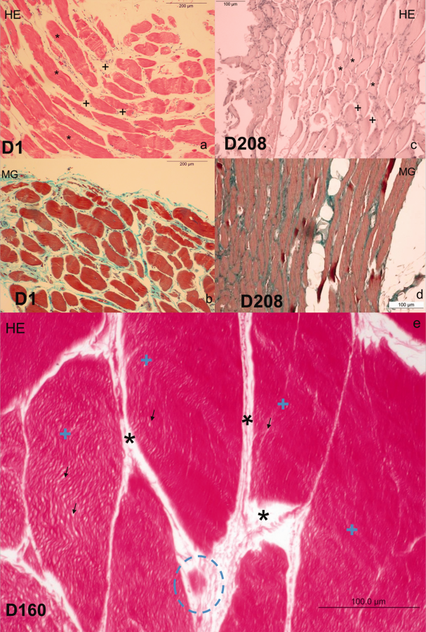 Gallery: What Mummifying a Human Body Looks Like | Live Science
