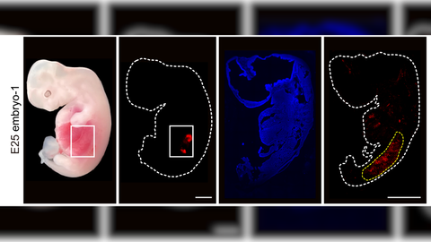 In a 1st, scientists grow human kidneys inside developing pig embryos ...