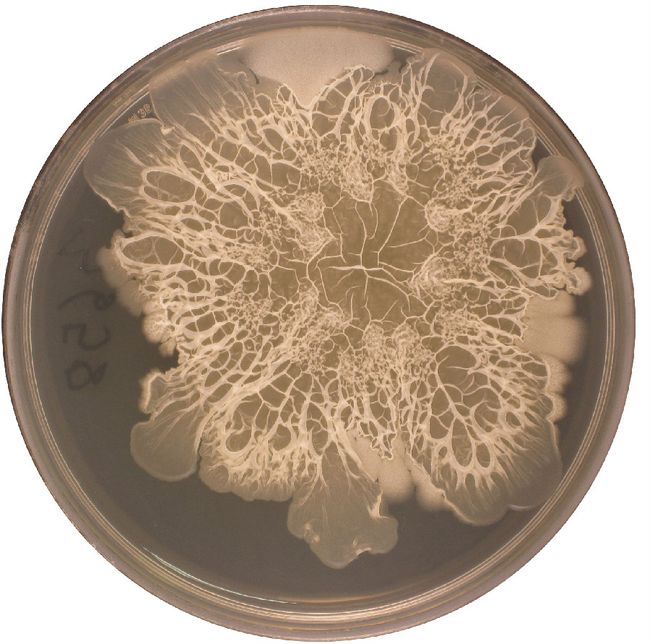 Gallery: Bacteria in Your Belly Button | Live Science