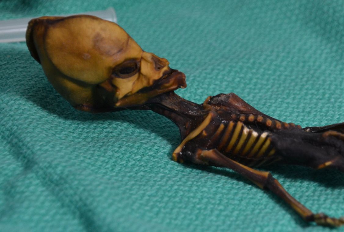 No, It's Not an Alien — Here's What That Tiny, Pointy-Headed Skeleton ...