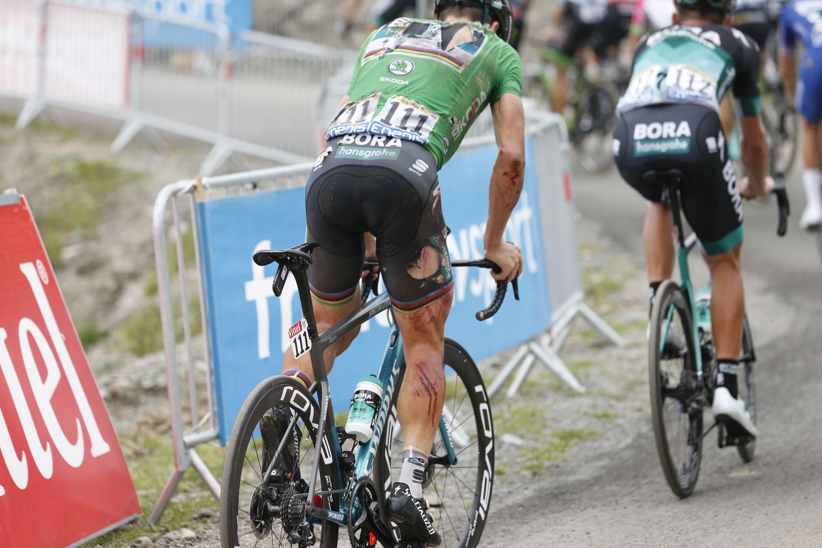 How to treat road rash | Cycling Weekly