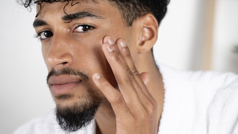 5 common summer skin issues and how to treat them, according to a ...