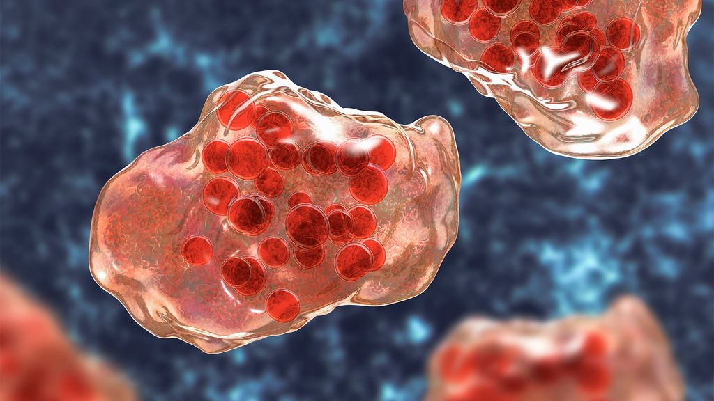 2 school-age children have died in Texas measles outbreak, as total ...