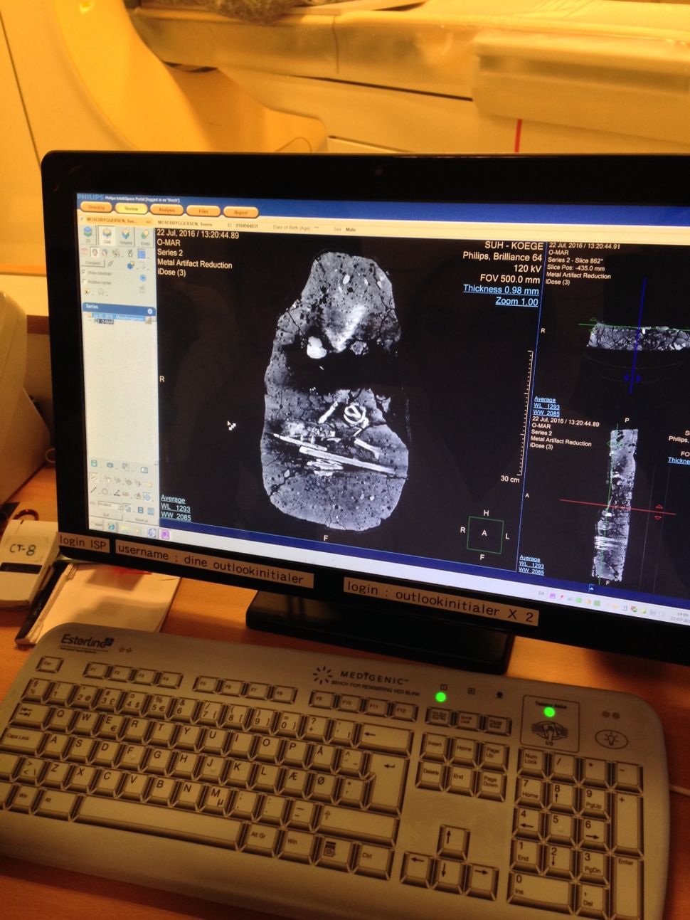 Photos: Viking-Age Tools Uncovered at Ring-Shaped Fortress in Denmark ...