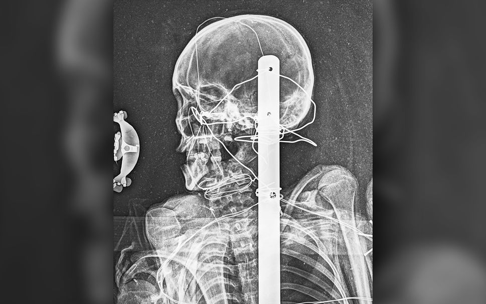 Mysterious Mummy Taken from Peru a Century Ago Was the Body of a Teen ...