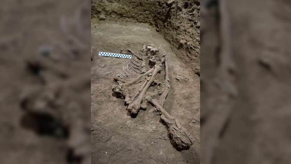 Oldest medical amputation on record was performed on a Stone Age child ...