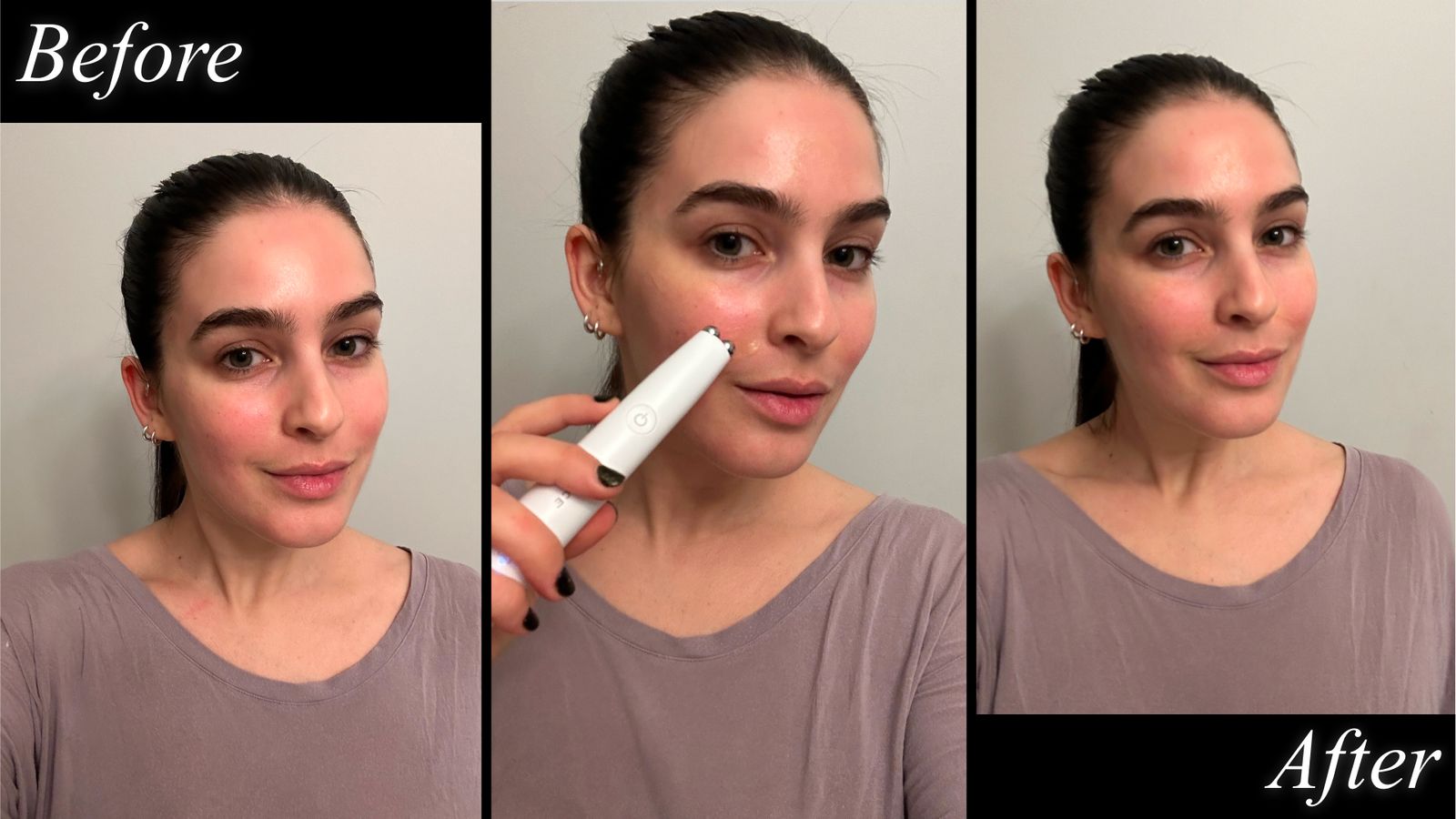 The 3 Best Microcurrent Facial Devices, Tested by Editors | Marie Claire