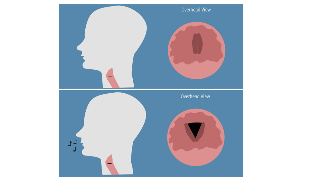 Researchers Grow Vocal Cord Tissue That Can 'Talk' | Live Science