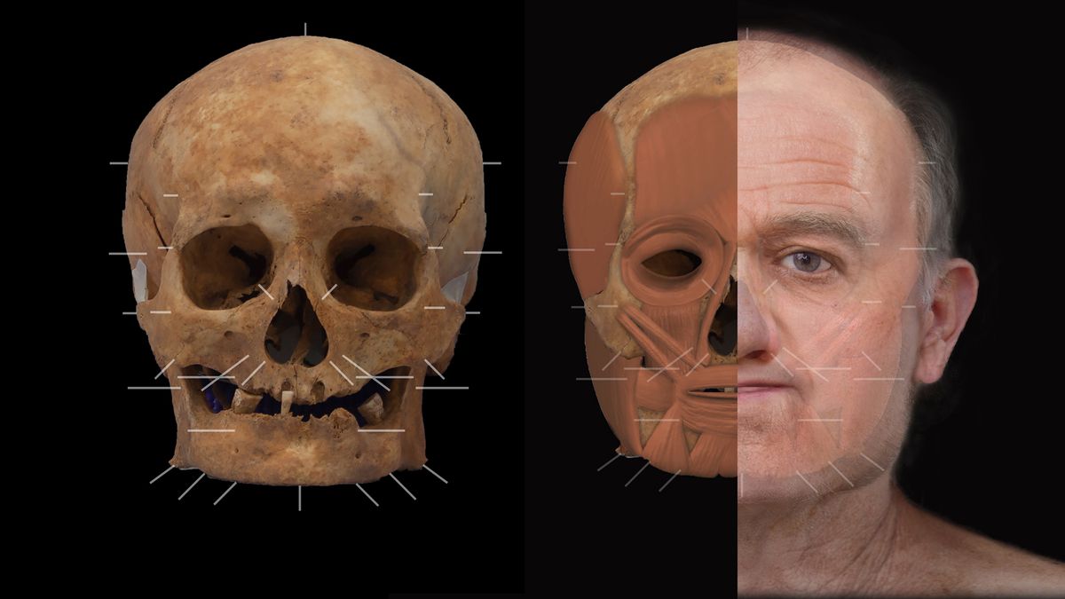 Medieval Scottish Man Who Died 600 Years Ago Was Short and Balding ...