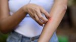 Mystery bites? How to identify what's really biting you | Tom's Guide