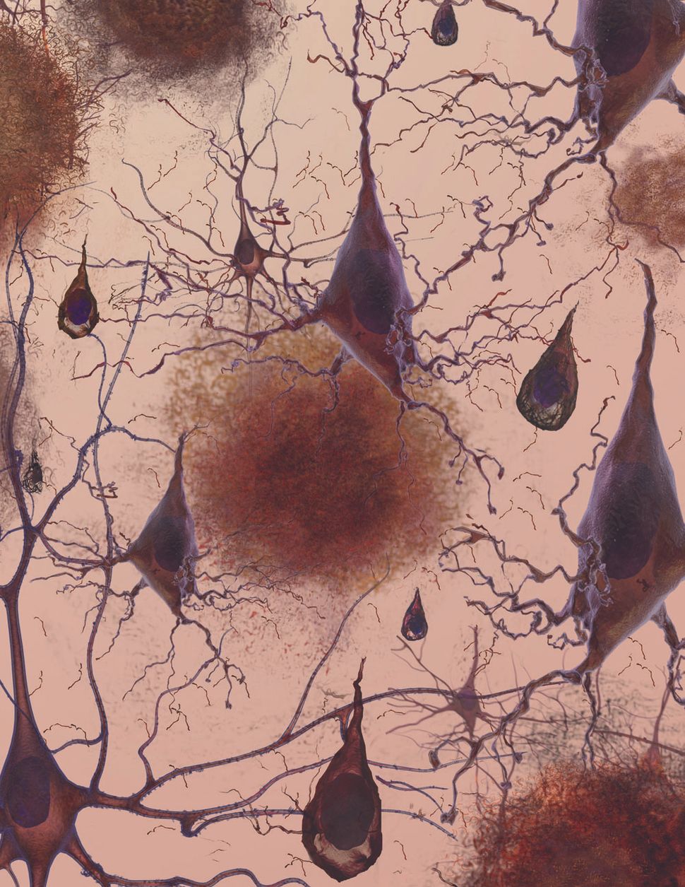 Inside Life Science: Mystery of Amyloid Plaques | NIGMS | Live Science