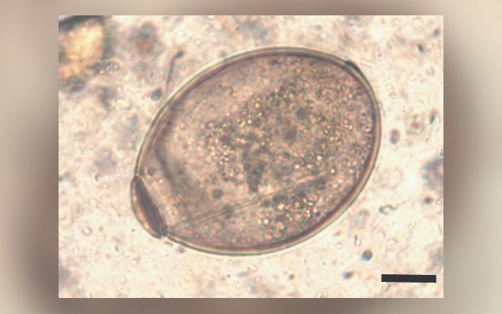 Medieval Germans Riddled with Tapeworms | Live Science