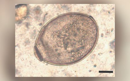 Parasites - News and Scientific Articles on Live Science - Page 5 ...