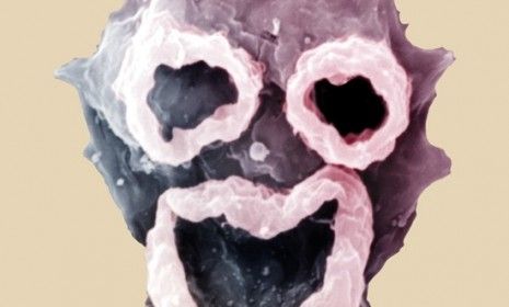 Brain-eating amoebas: A deadly threat? | The Week