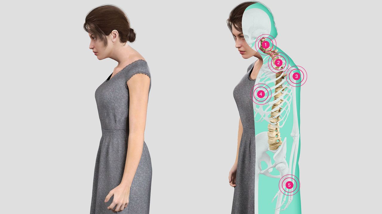 5 long-term effects of poor posture (and how to avoid them) | T3
