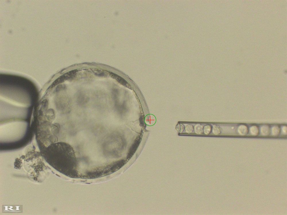 Human-Pig Chimeras Created, Could One Day Aid in Organ Transplants ...