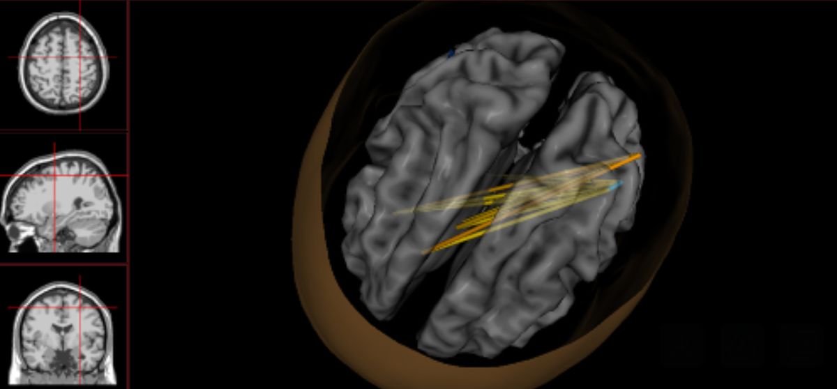 Guitarist's music therapy offers pain relief for patients | GuitarPlayer