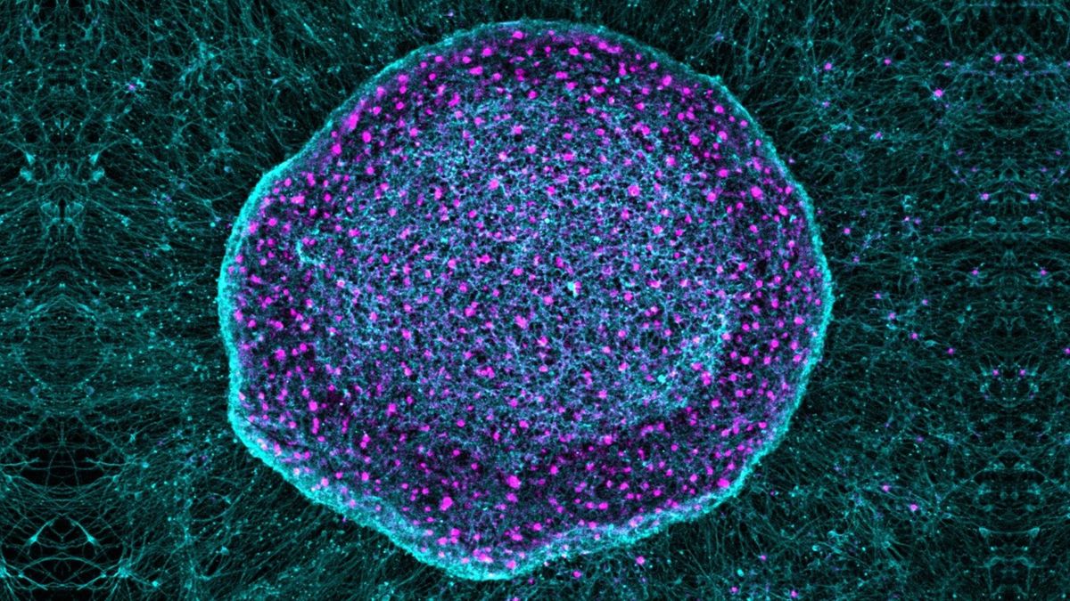'Pain sponge' derived from stem cells could soak up pain signals before ...