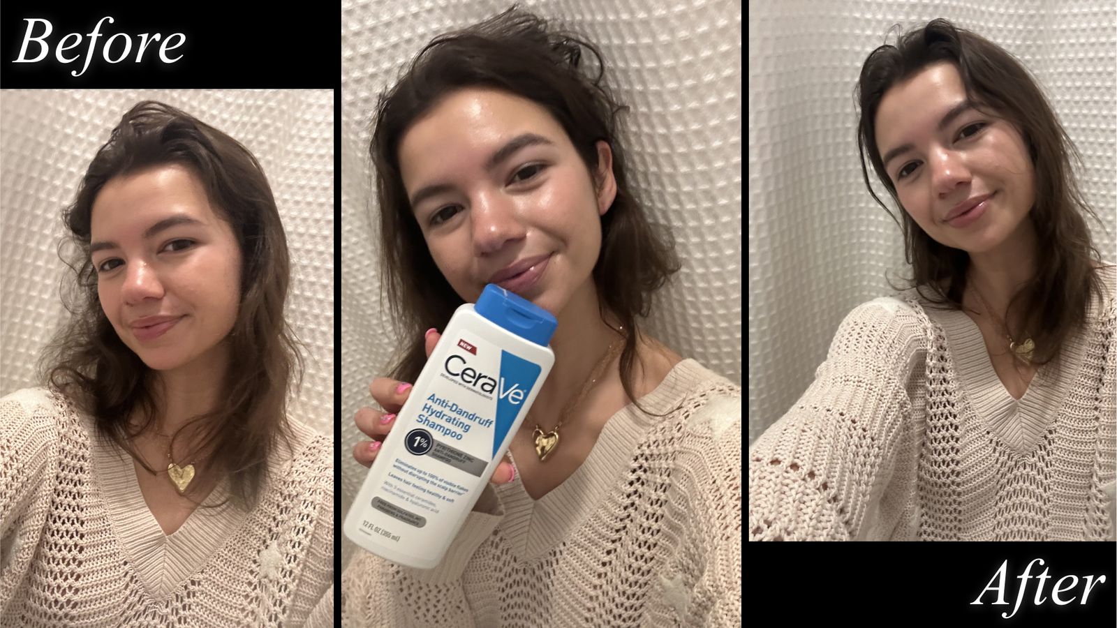 5 Best Dandruff Shampoos for a Flaky Scalp, Reviewed | Marie Claire