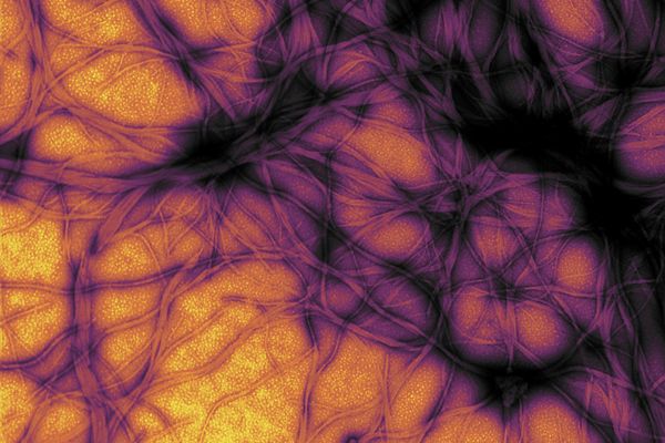 How Cells Take Out the Trash | Live Science