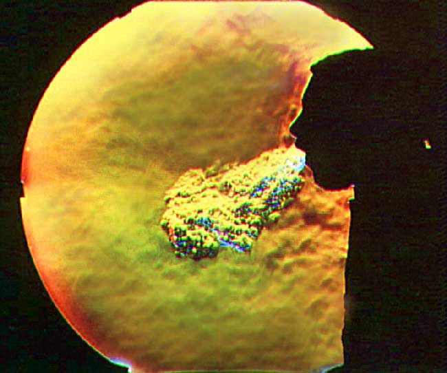 The Gross Science of a Cough and a Sneeze | Live Science