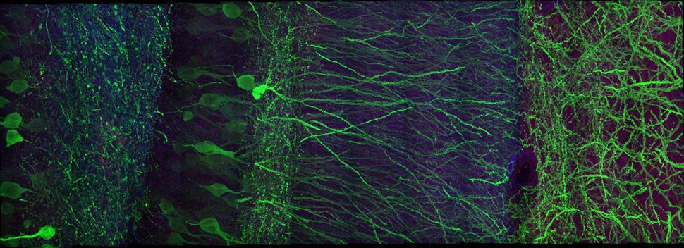 Unlocking the Secrets of the Brain | Live Science