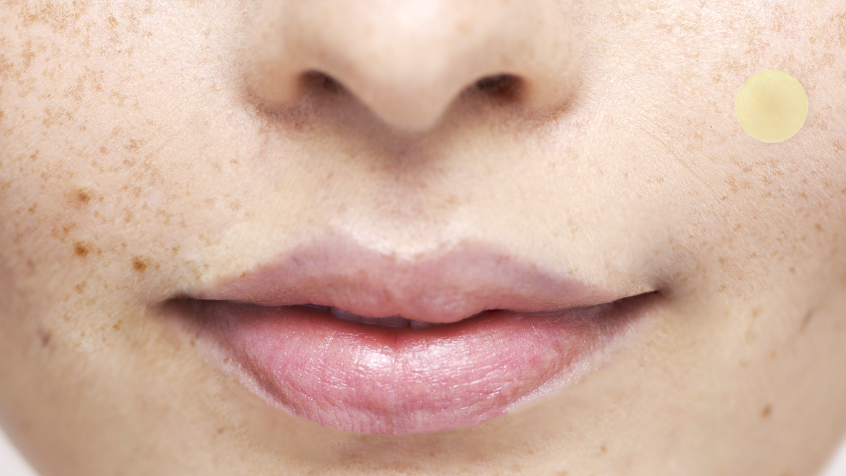 Pimple Sticker Benefits - Best Way to Zap Zits | Marie Claire