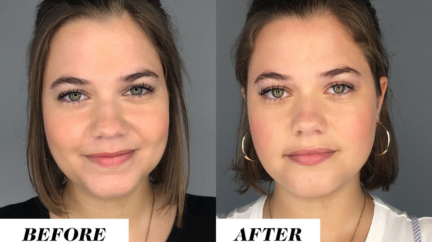 Does Drinking Water Help Your Skin - Facts on Drinking Water for Acne ...