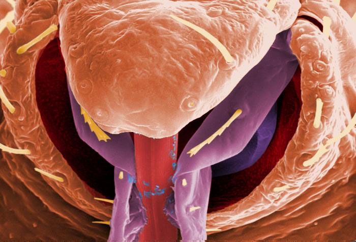 Up Close & Personal: A Bedbug Album | Live Science