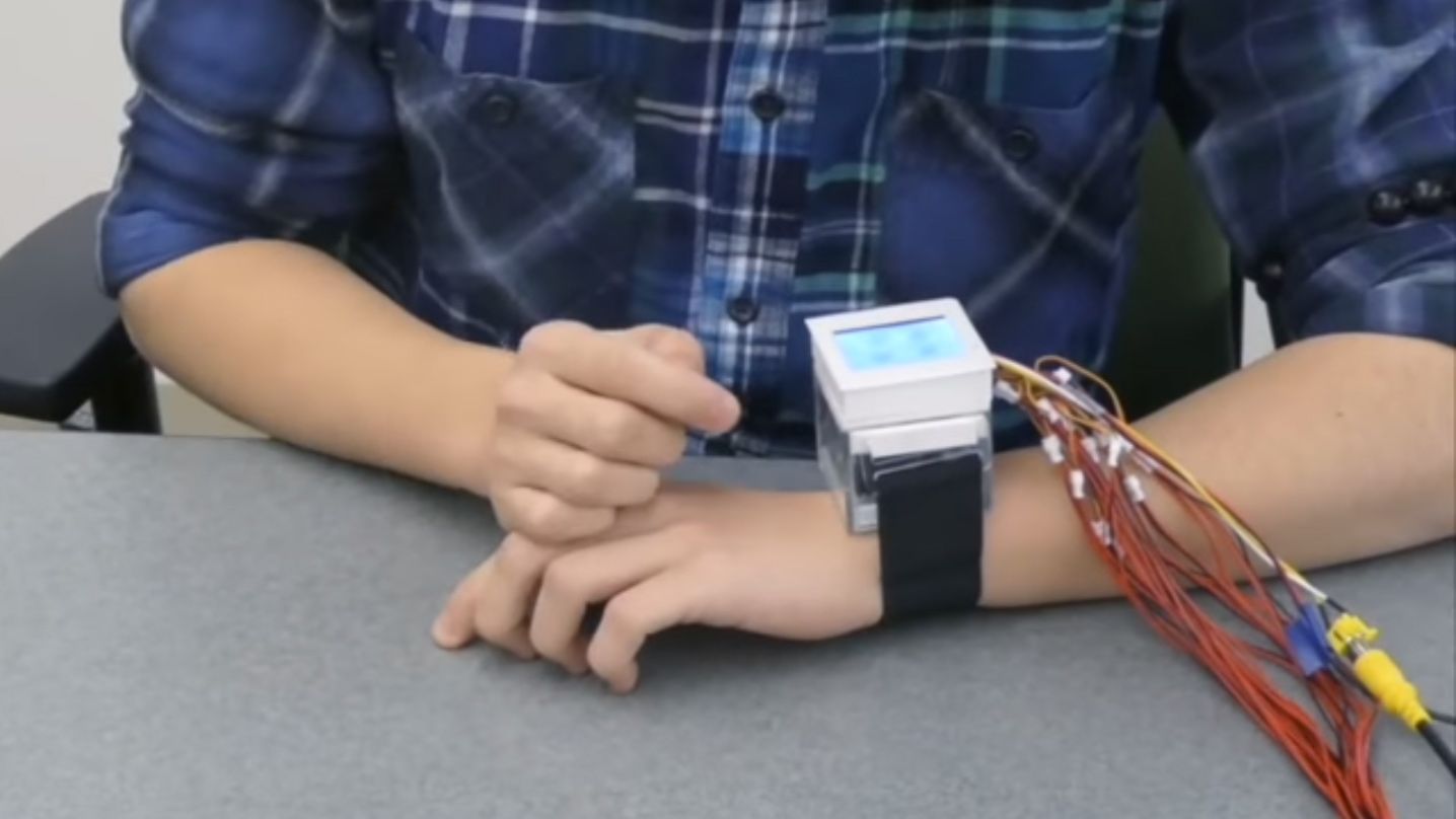 This giant smartwatch prototype has a shape-deforming backplate | TechRadar