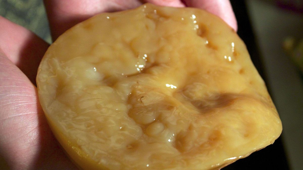 What is a scoby? | The Week