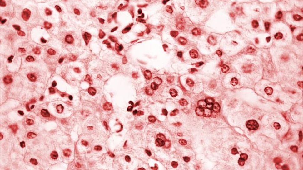 Can viruses cause cancer? | Live Science