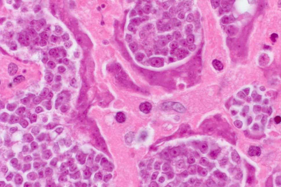 8 awful parasite infections that will make your skin crawl | Live Science