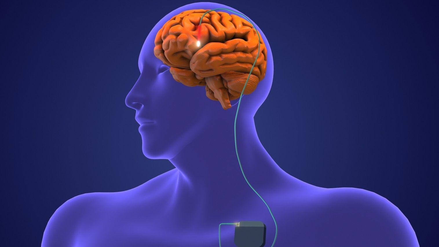 Electrical stimulation could treat traumatic brain injuries | Live Science