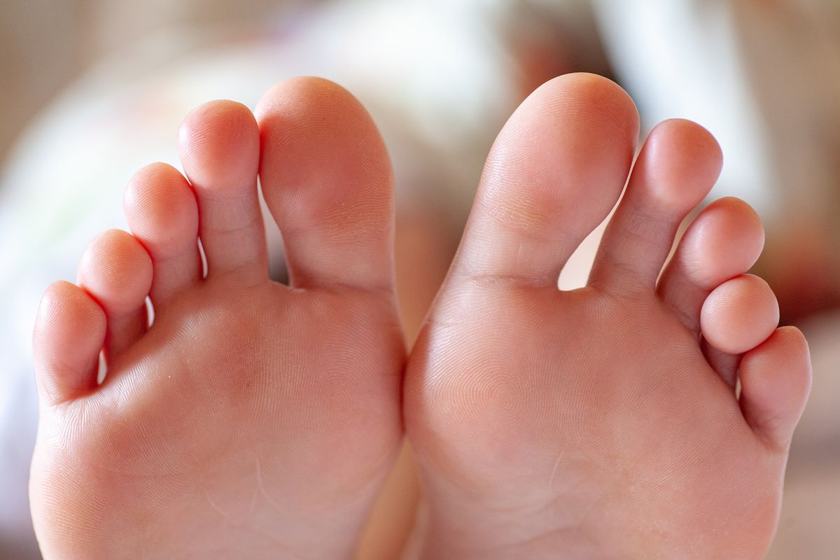 Are covid Toes A Real Symptom Of The Coronavirus Live Science Are covid Toes A Real Symptom Of The Coronavirus Live Science