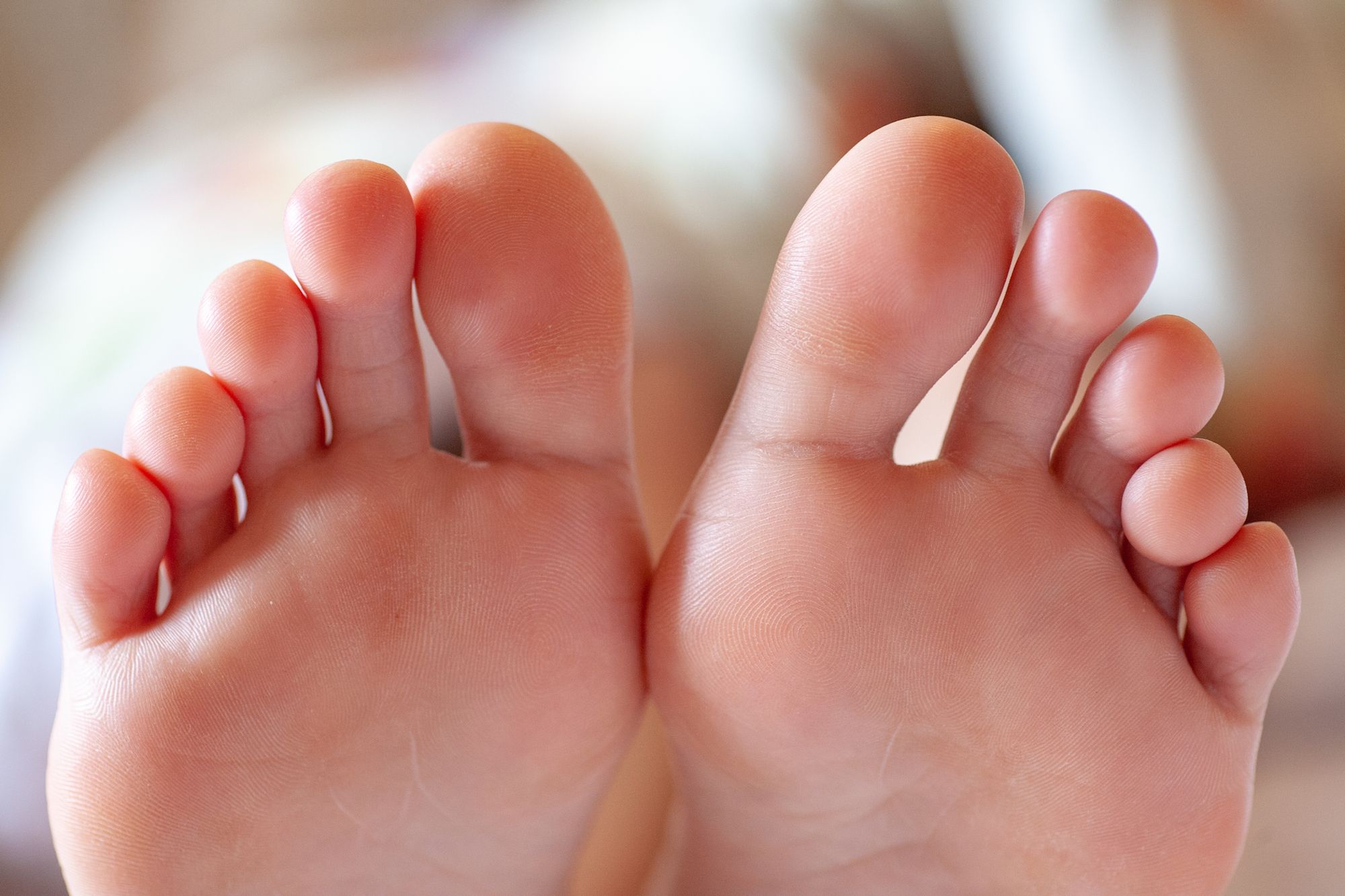 Are 'covid toes' a real symptom of the coronavirus? | Live Science